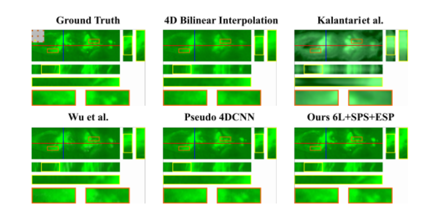High-fidelity View Synthesis for Light Field Imaging with Extended Pseudo 4DCNN | SIR-Smart Iris ...